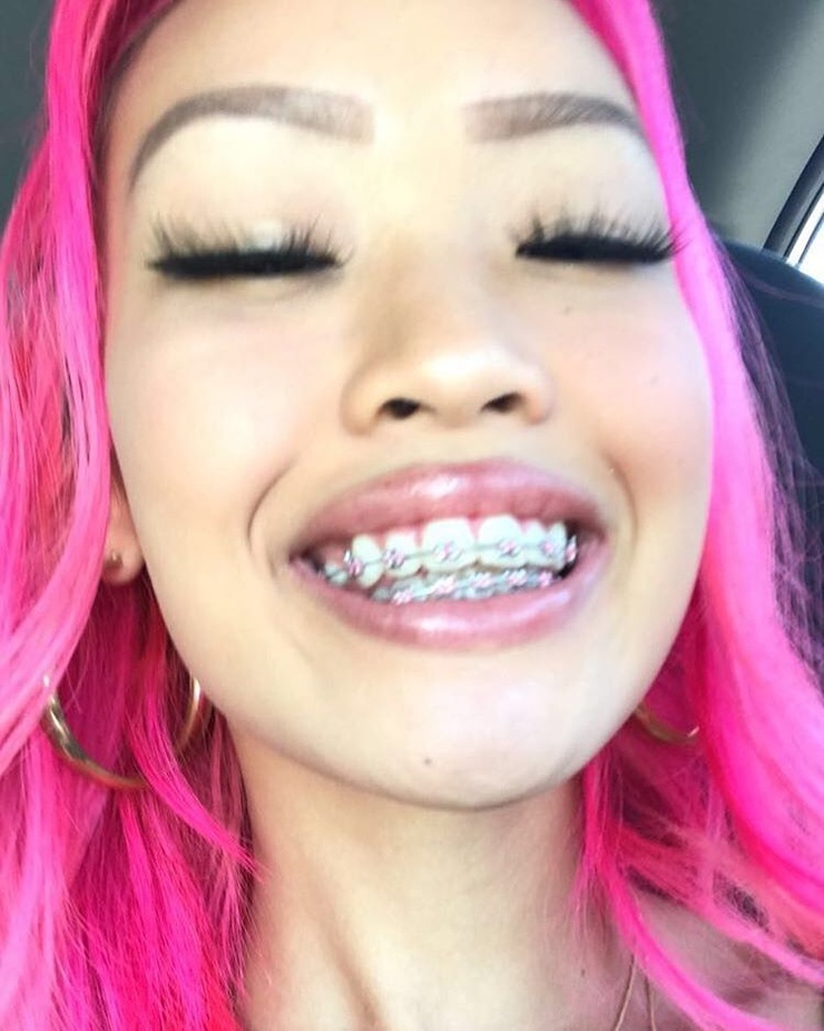 Picture of Chinqpink