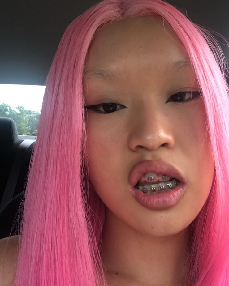 Chinqpink image