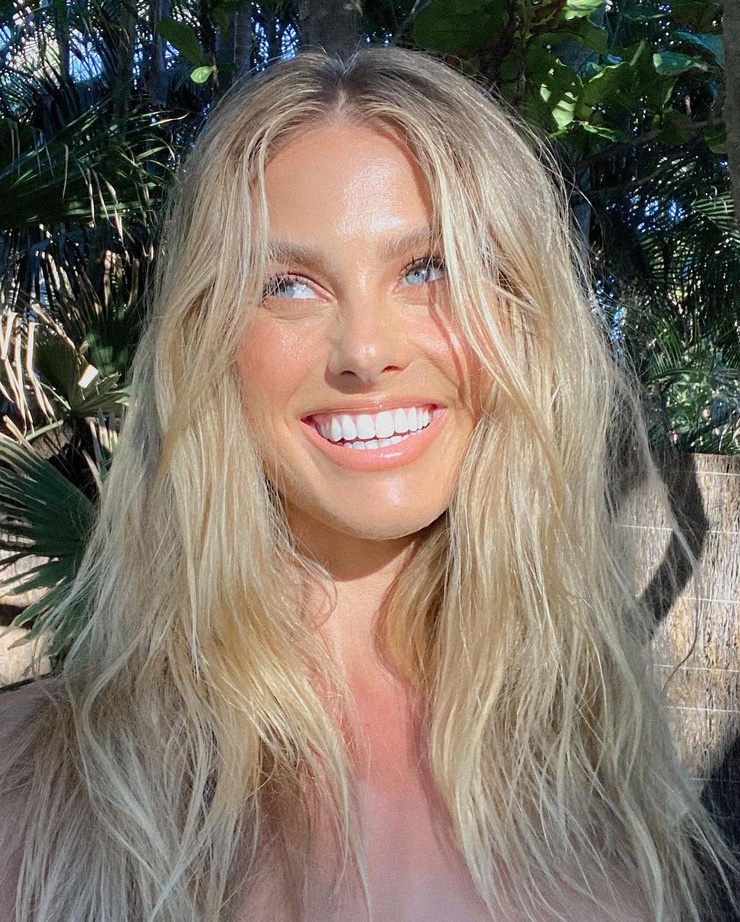 Natalie Roser picture