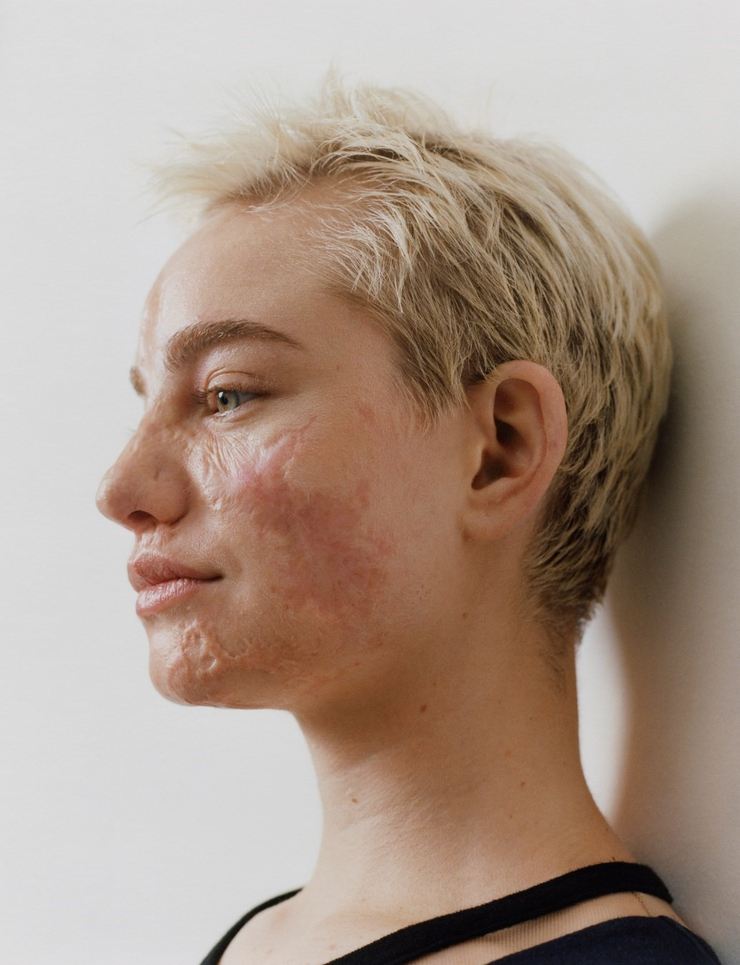 Picture of Beatrice Vio