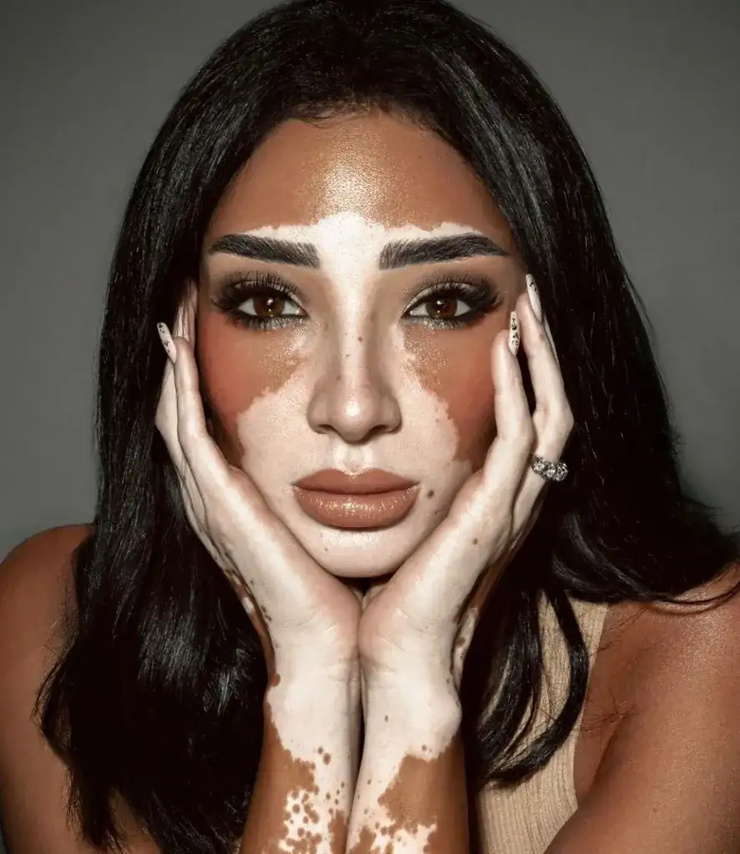 Picture of Logina Salah