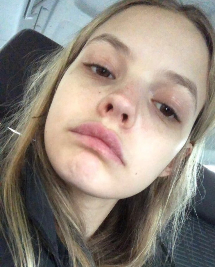 Picture of Alana Champion