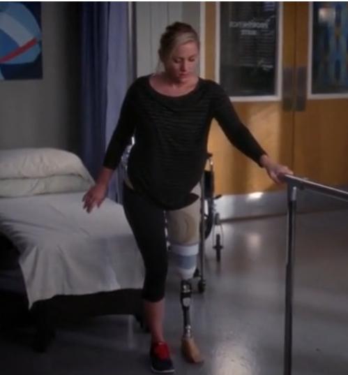 Jessica Capshaw Leg Amputation In Real Life